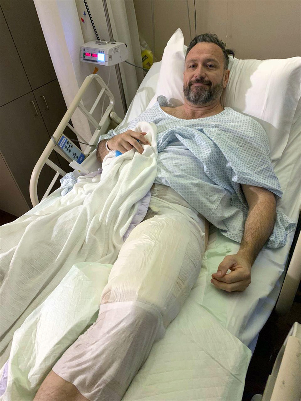 Man vir 2 maande in hospitaal ná e-sigaret ontplof | Netwerk24