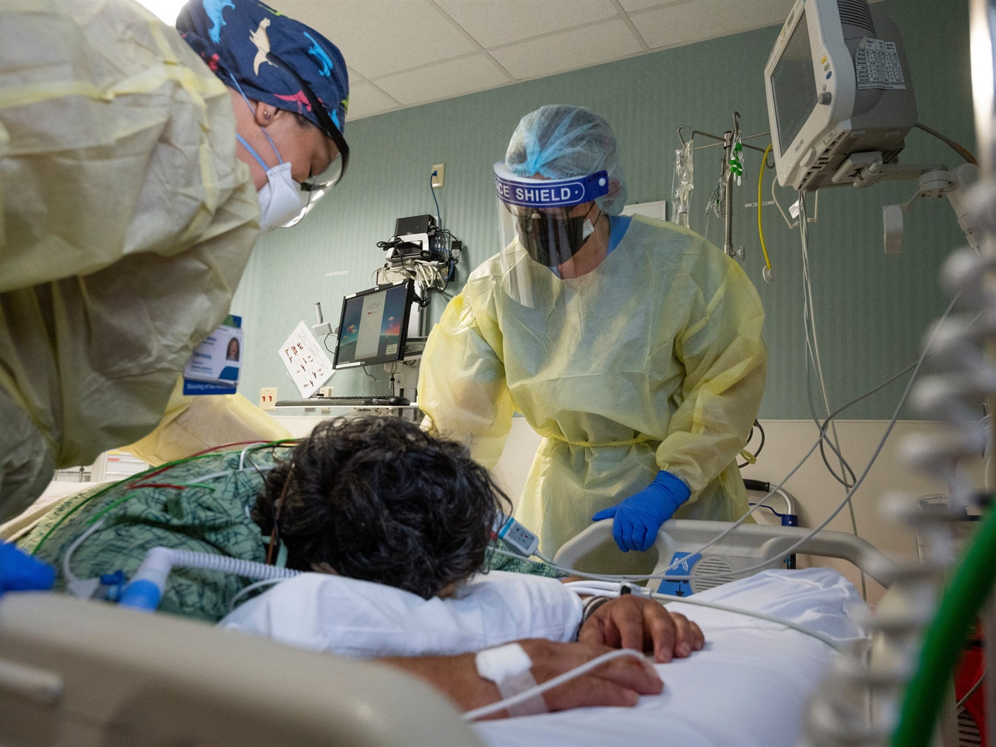 Obesity linked to Covid-19 death and longer ICU stay, study finds | Life