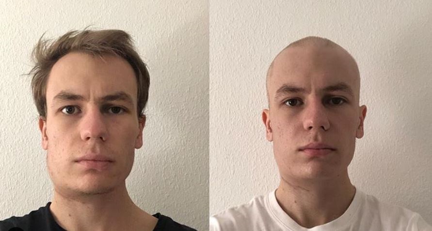 Bloedjong Kapenaar praat oor sy stryd teen seldsame kanker | Netwerk24