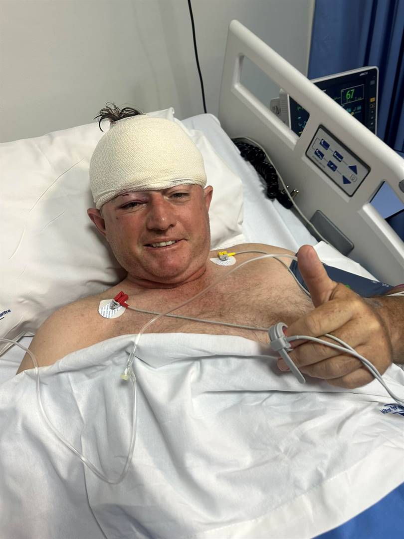 Oud-sportster van Zim ‘2de keer gelukkig’ ná luiperd-aanval | Netwerk24
