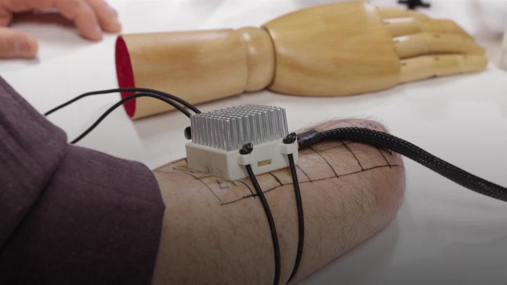 WATCH | Scientists develop device that allows amputees to feel warmth ...