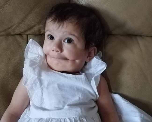 Cape Town girl born with rare syndrome that makes her look like she's ...