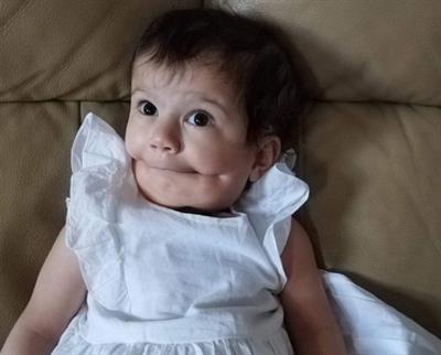 Cape Town girl born with rare syndrome that makes her look like she's ...