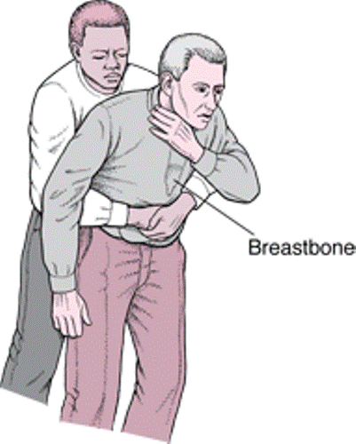 What to do when someone is choking | News24