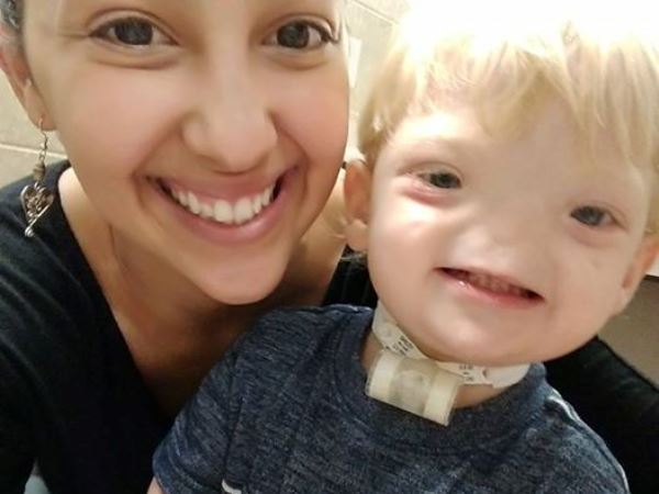 'Miracle baby' born without a nose dies at age two | News24