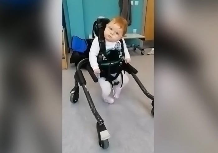WATCH | Toddler defies odds after doctors said she would never walk ...